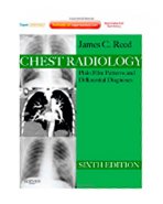 CHEST RADIOLOGY: PLAIN FILM PATTERNS AND DIFFERENTIAL DIAGNOSES | R2 ...